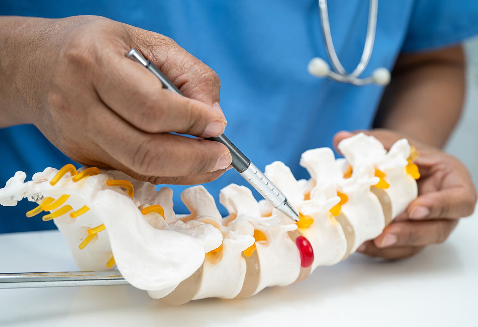 What is a Herniated Disc? A Spine Surgeon Breaks it Down | The Well by ...