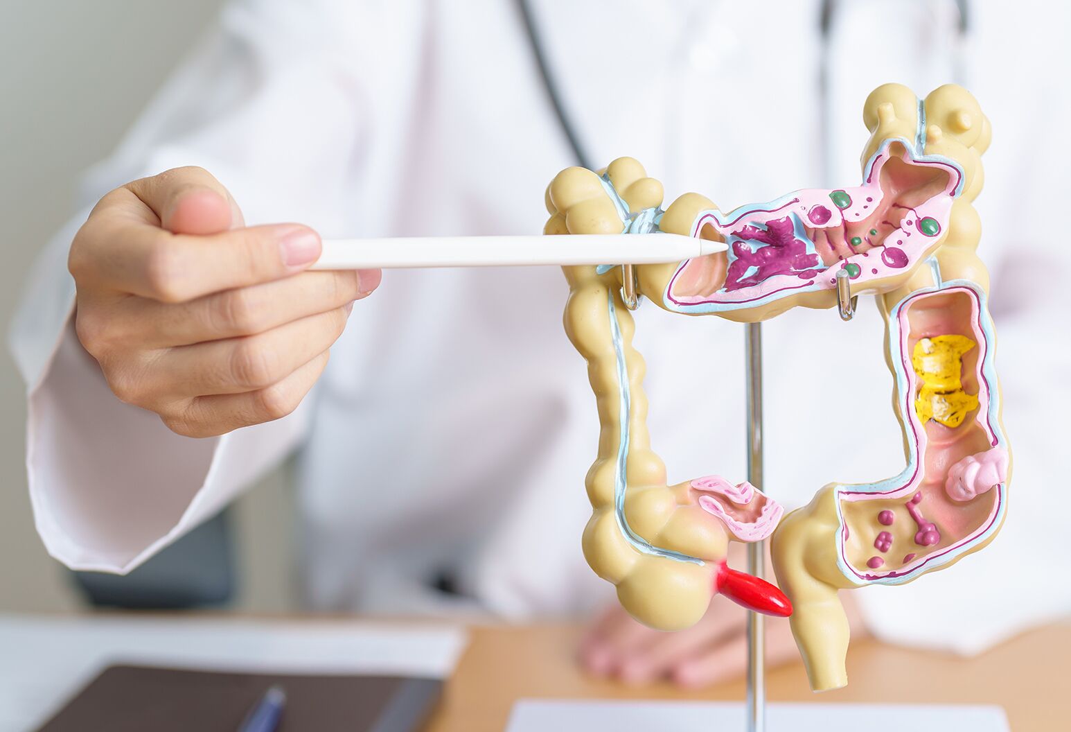 Colon Cancer: Foods to Avoid, According to a Cancer Researcher | The ...