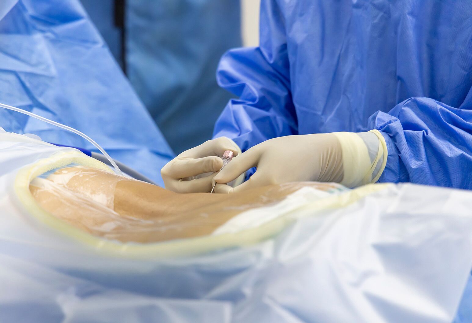 Microdiscectomy Surgery Time