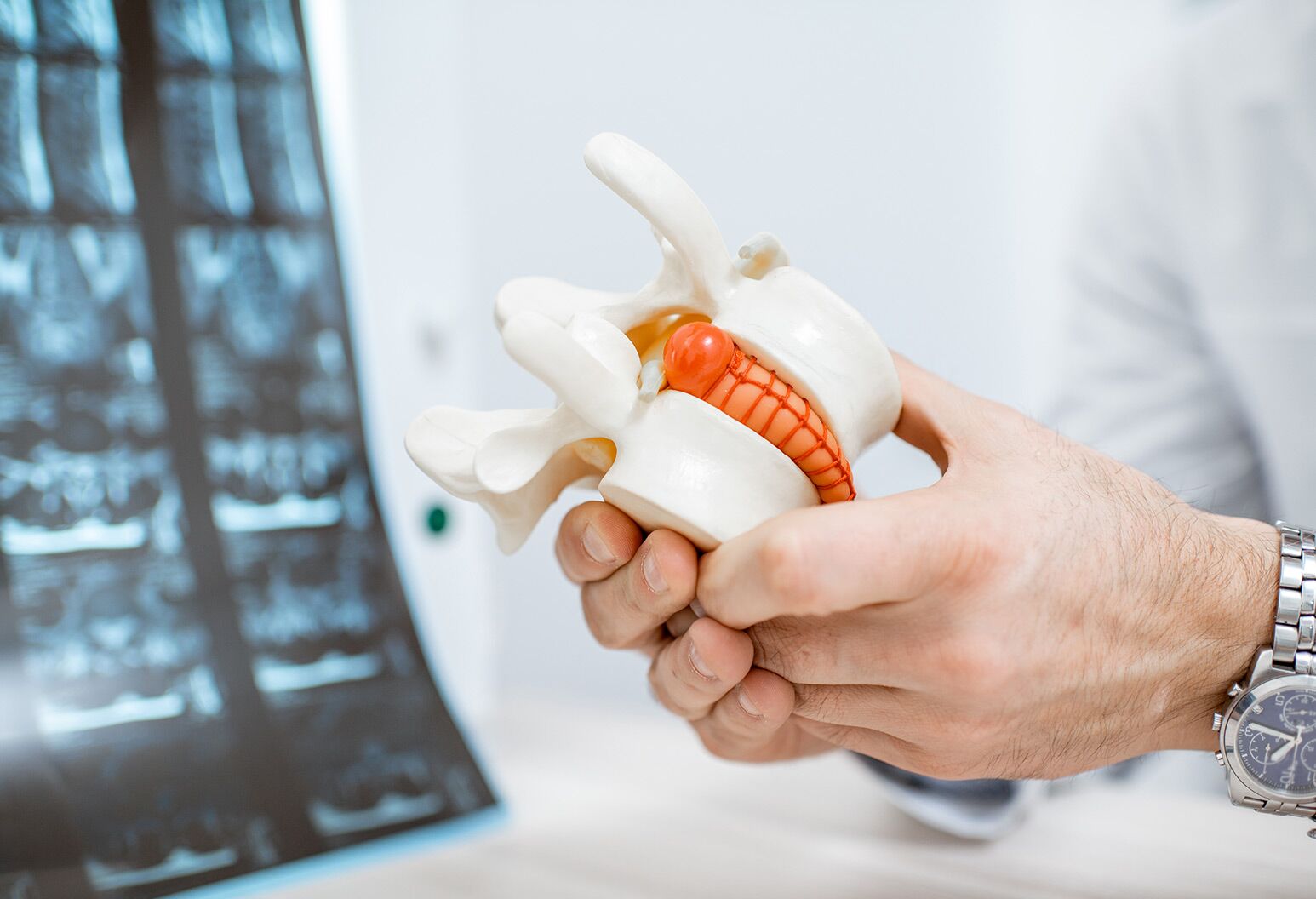 Where Herniated Disc Symptoms Show Up (And What They Mean) | The Well ...