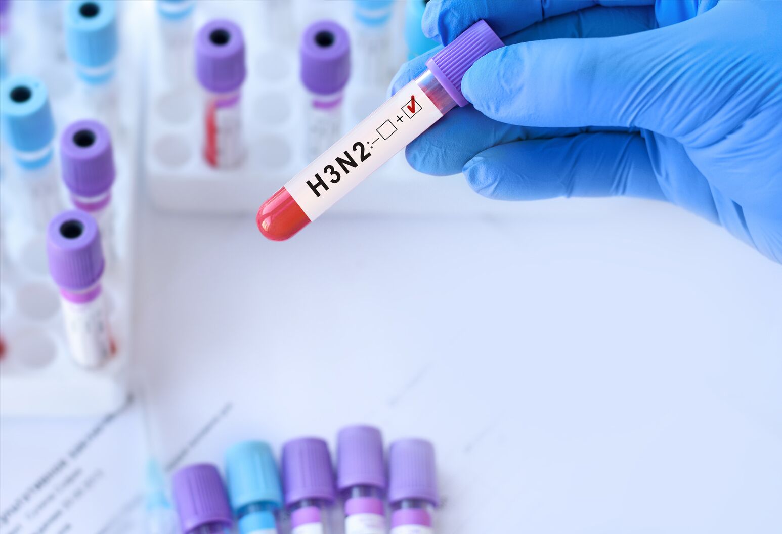 What Is A Titer Test And What Does It Measure? | The Well by Northwell