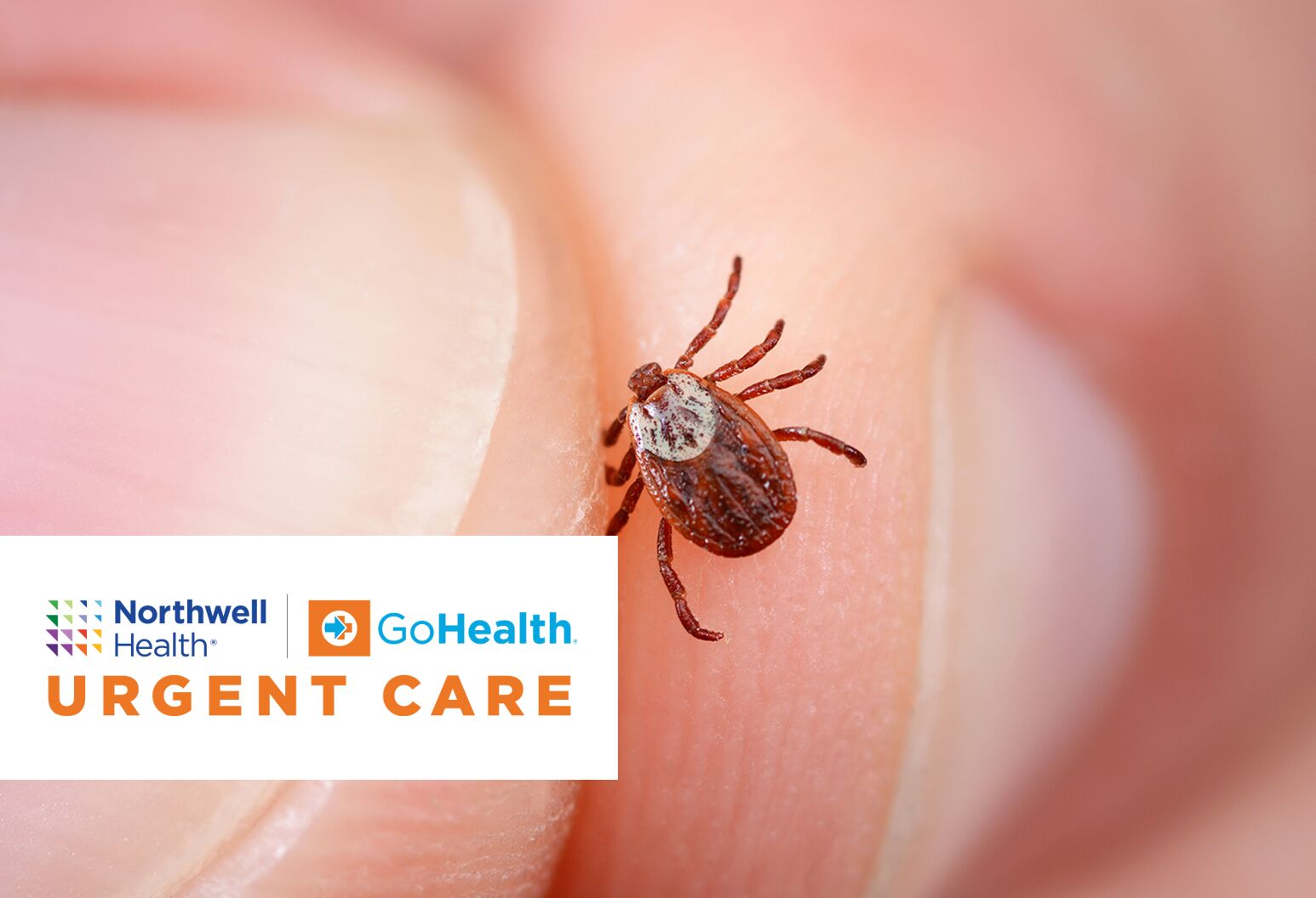Bit By A Tick? Follow These Steps | The Well by Northwell