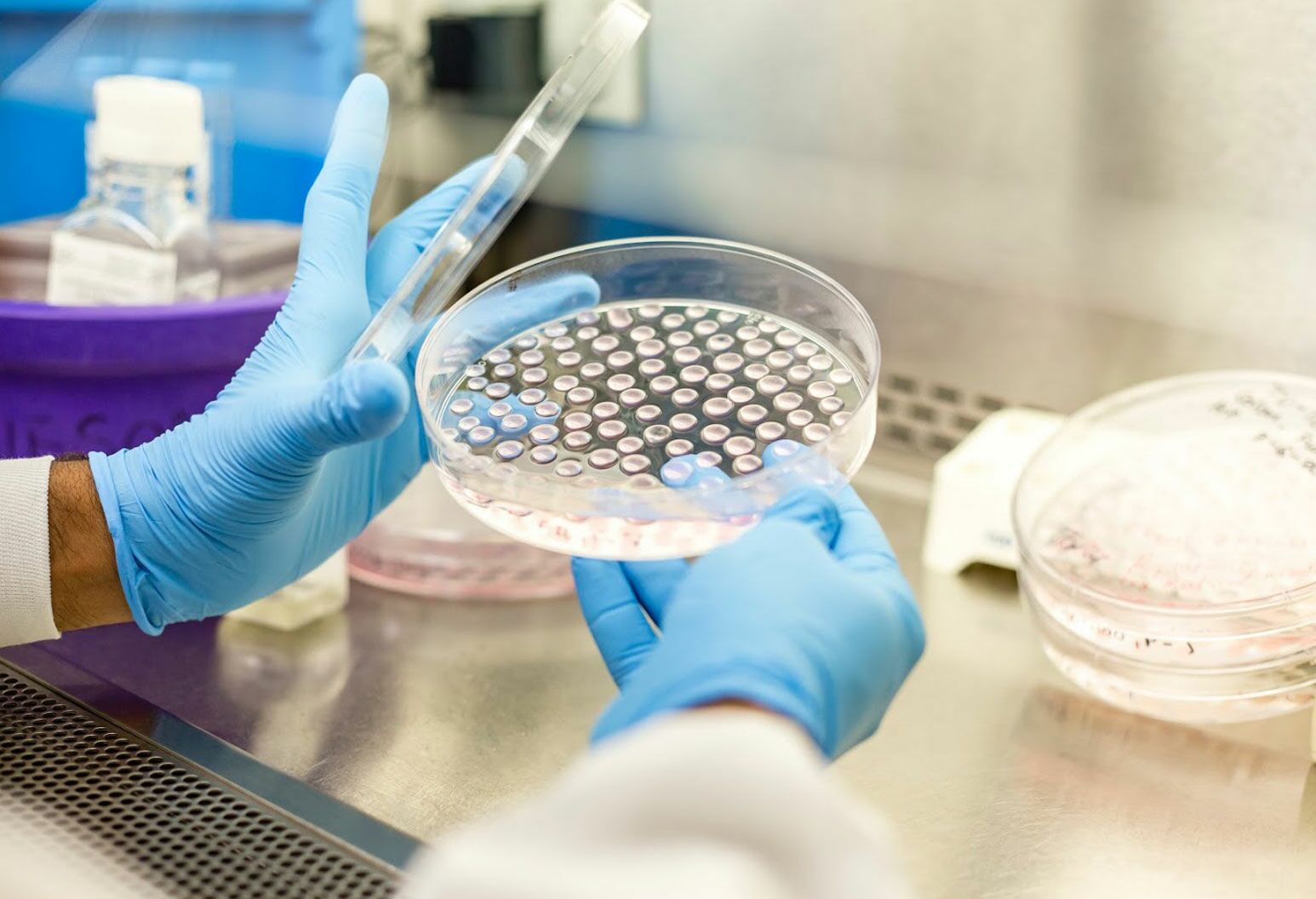 Research & clinical trials - Pancreatic cancer - Cancer Institute ...