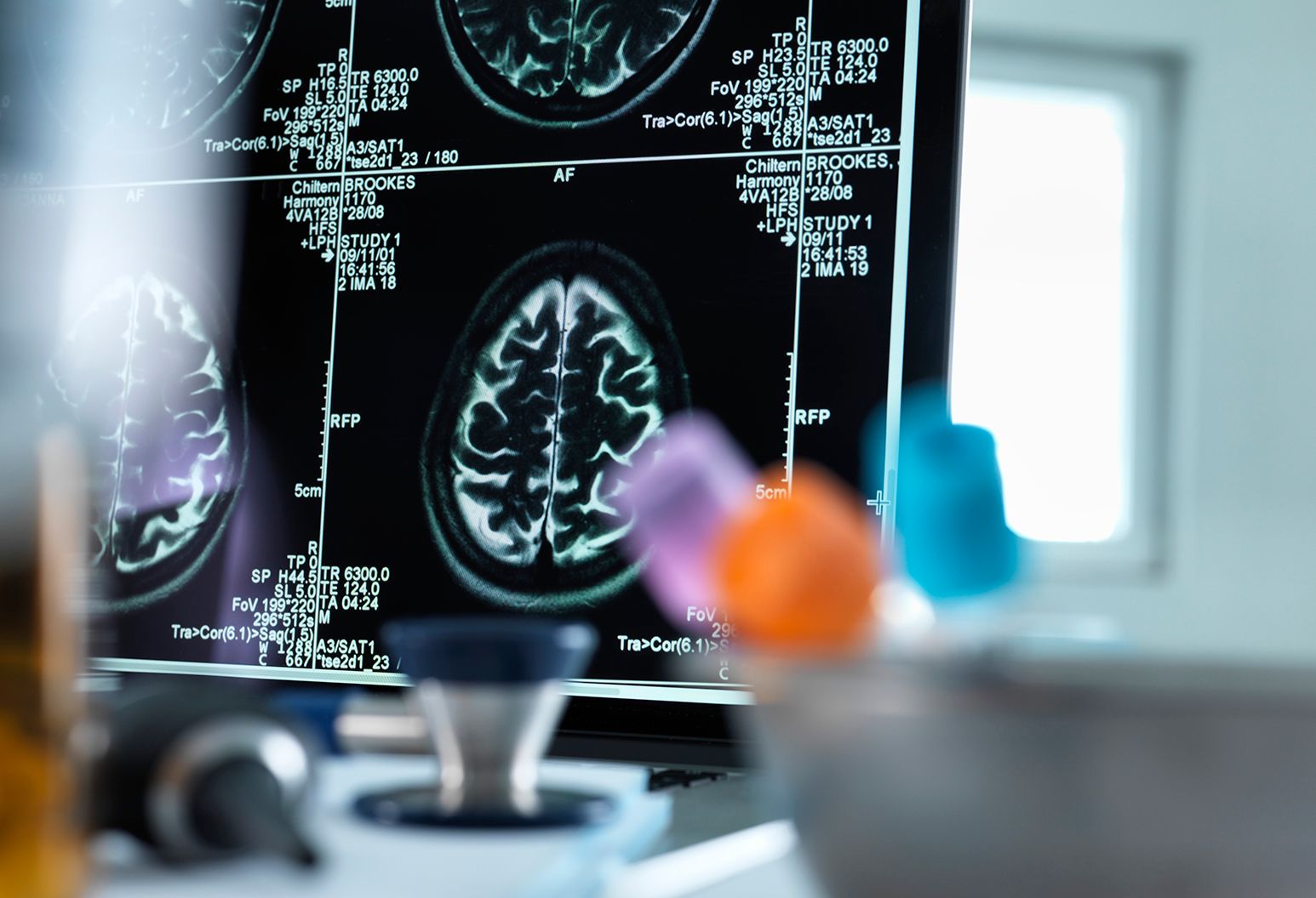 Neurology - Northern Westchester Hospital | Northwell Health