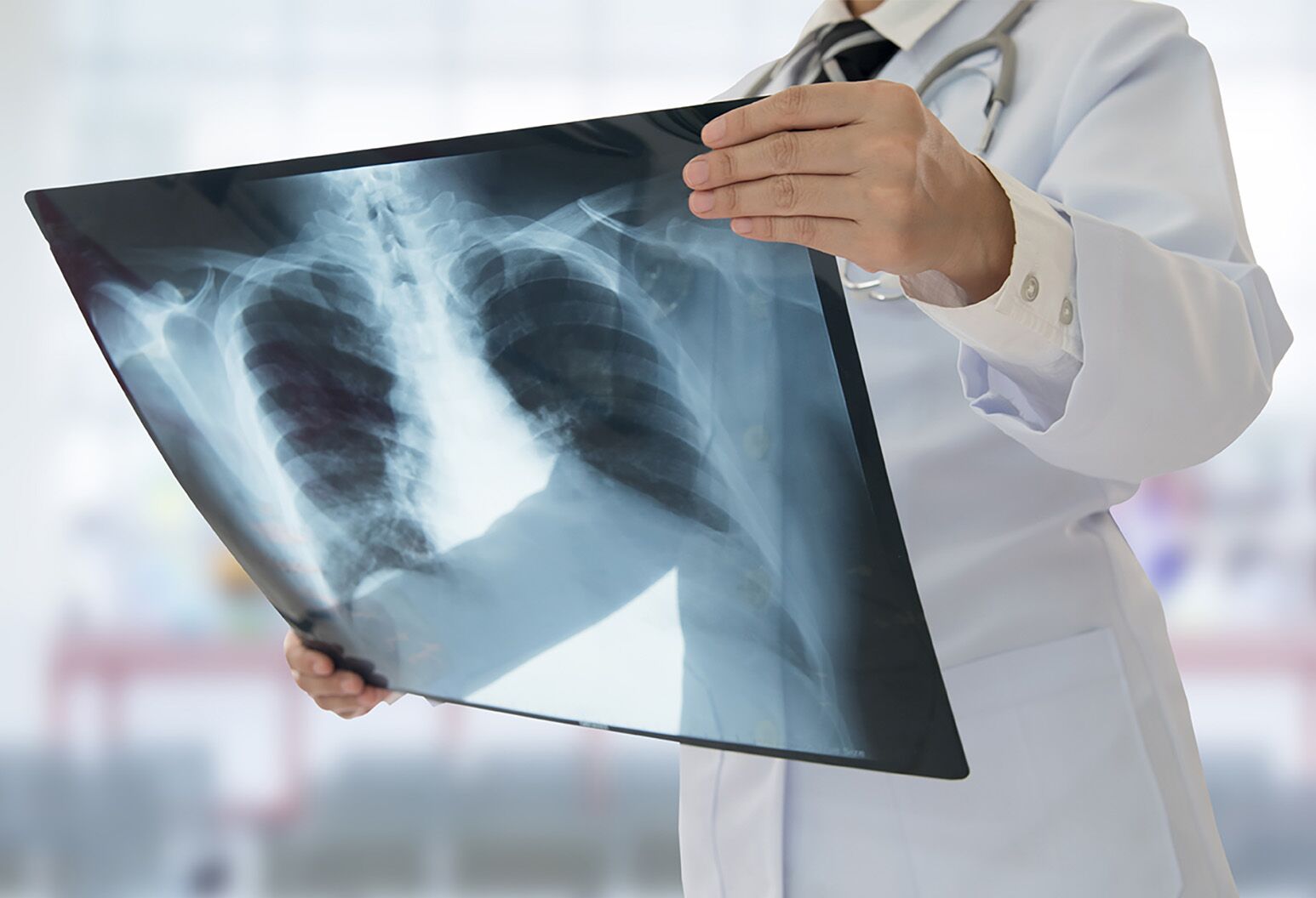 Northwell Health simplifies radiology results with interactive patient ...