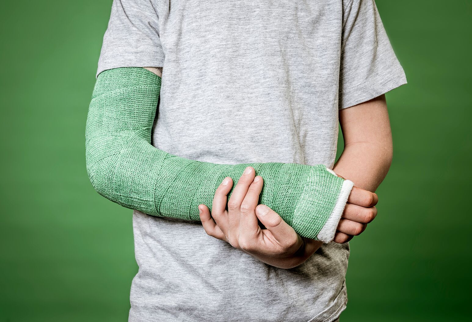 Common Bone Fractures: What They Look Like | The Well by Northwell