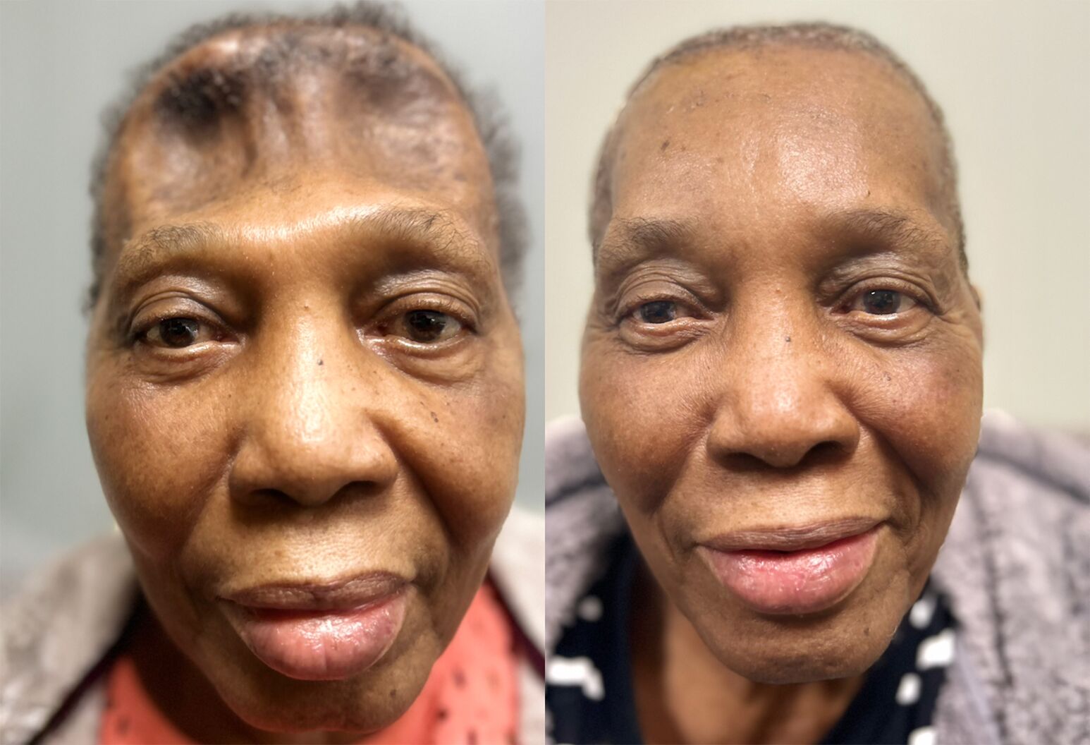 Neuroplastic & reconstructive surgery - Neurosurgery - Lenox Hill ...