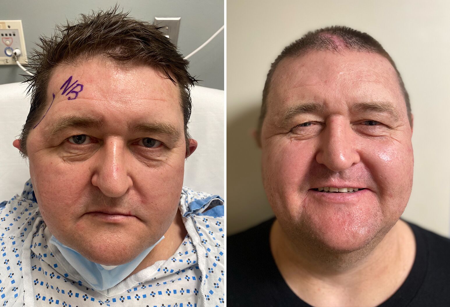 Neuroplastic & reconstructive surgery - Neurosurgery - Lenox Hill ...