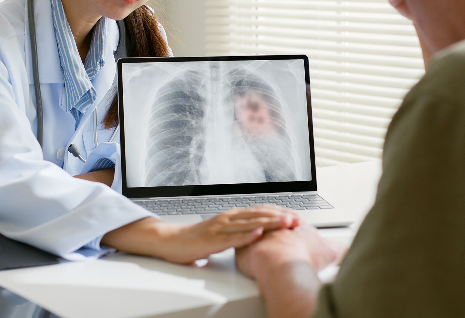 Lung Cancer Screening Guidelines: What Changed? | The Well by Northwell