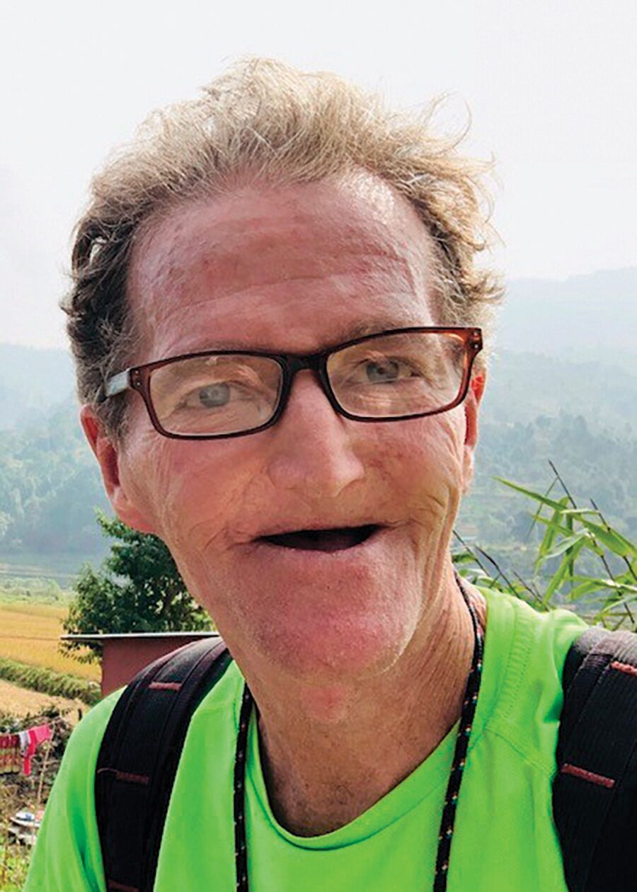 Jaw in a-Day surgery restores squamous cell carcinoma survivor’s face ...