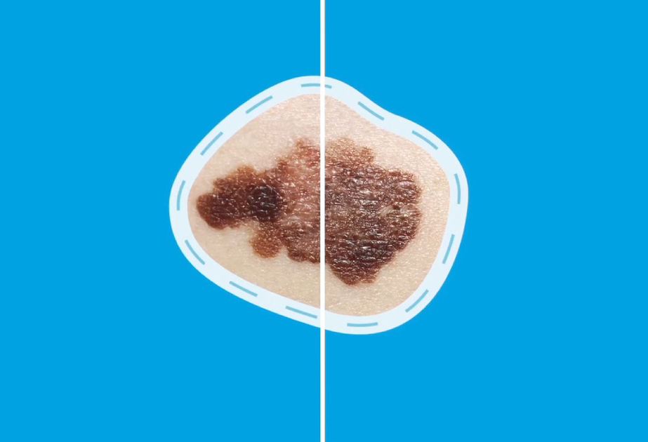 Women’s dermatology - Katz Institute for Women’s Health | Northwell Health