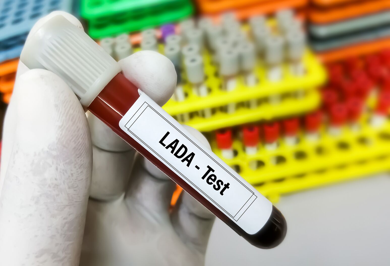 How LADA Diabetes Gets Diagnosed | The Well by Northwell