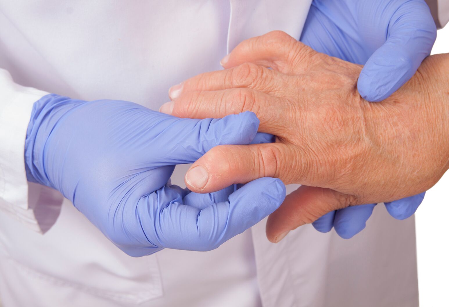 Rheumatoid Arthritis: 5 Management Strategies | The Well by Northwell