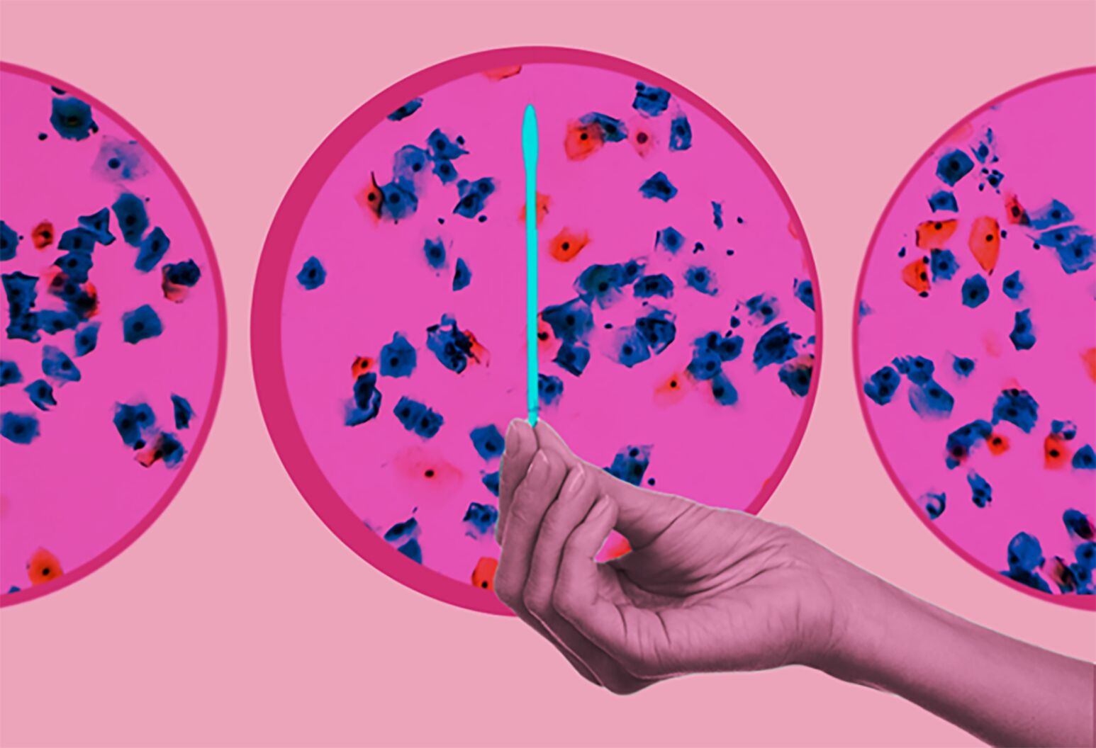Northwell, Stacker examine new Pap smear alternative | Northwell Health