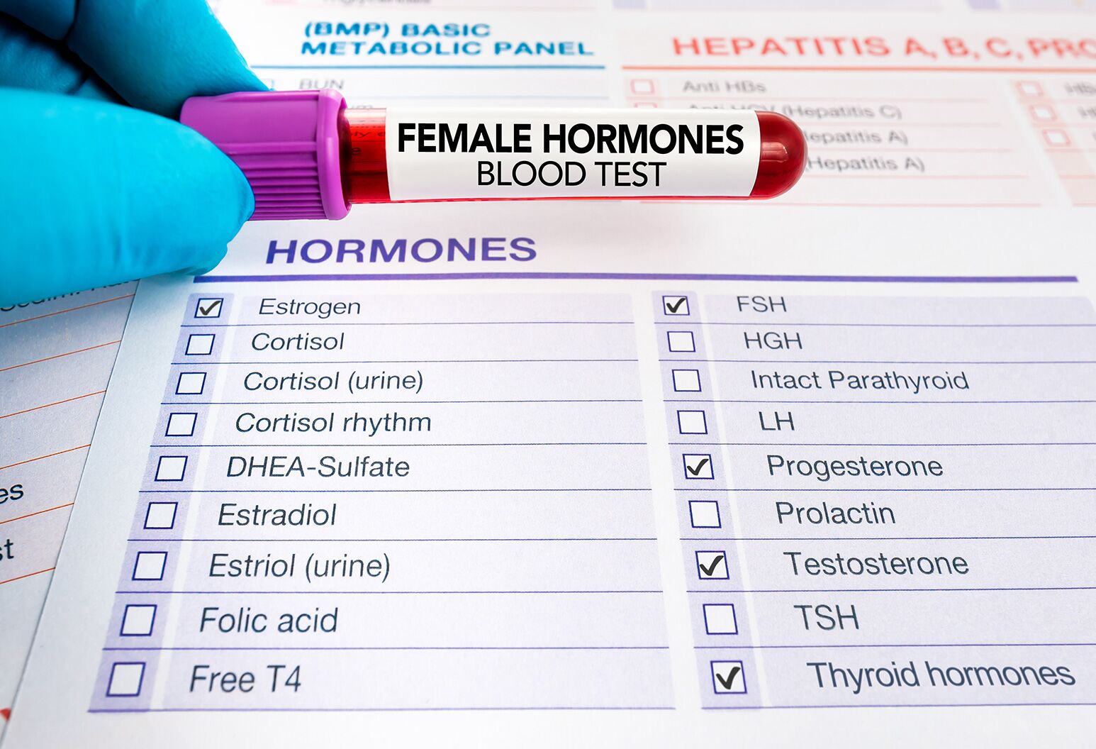 Estrogen Vs. Progesterone: Hormones, Compared | The Well by Northwell