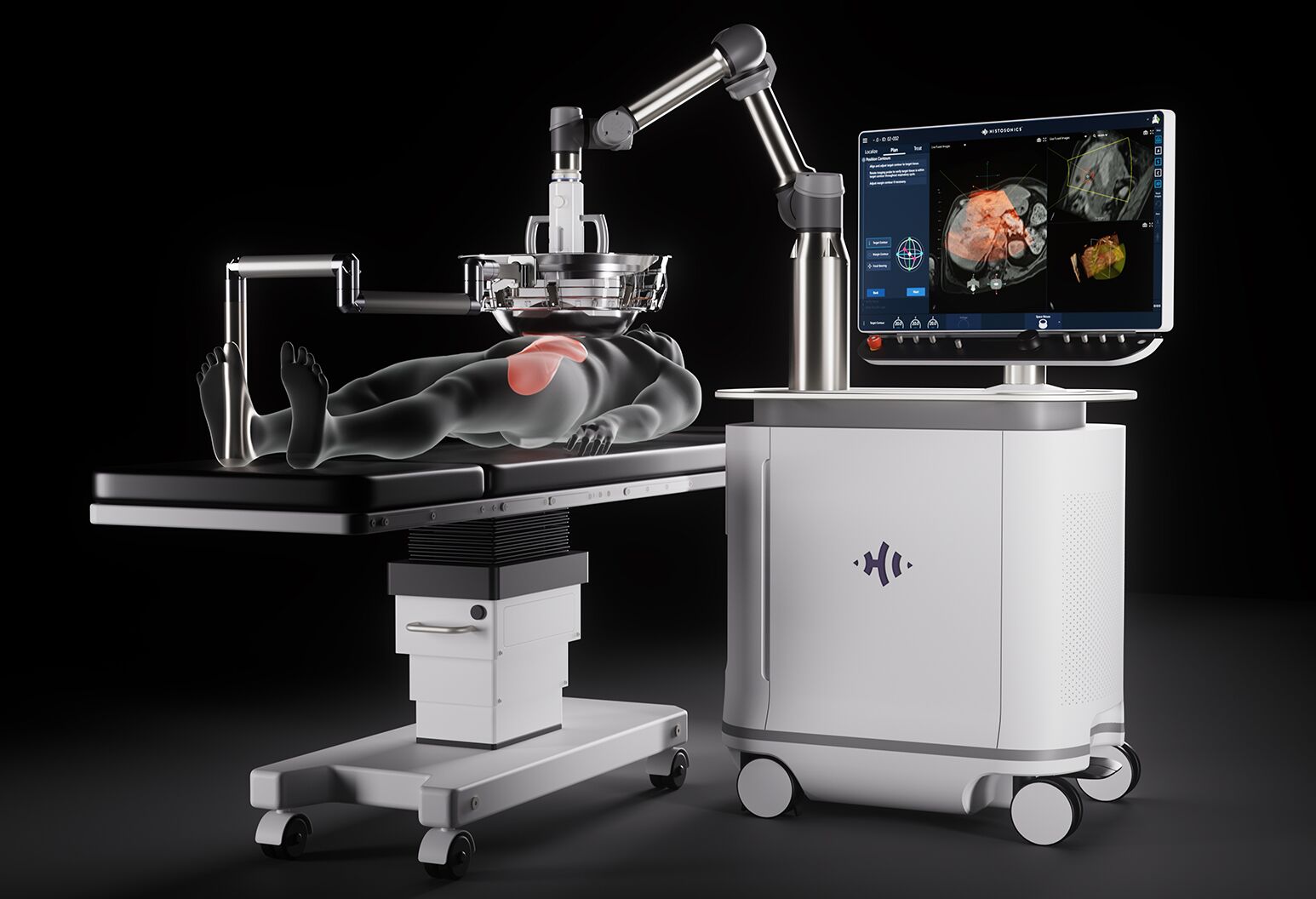 Histotripsy - Cancer Institute | Northwell Health