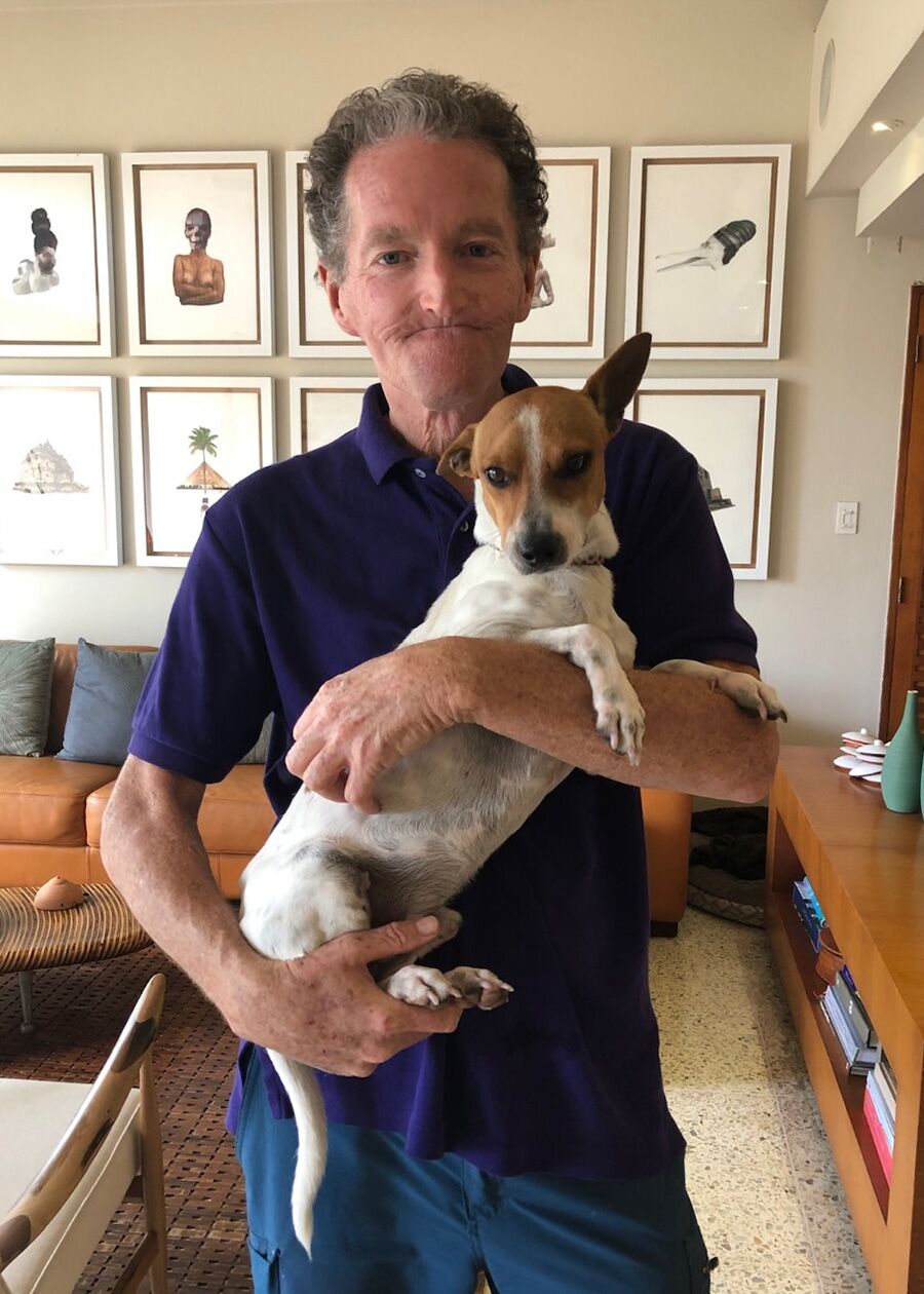 Jaw in a-Day surgery restores squamous cell carcinoma survivor’s face ...